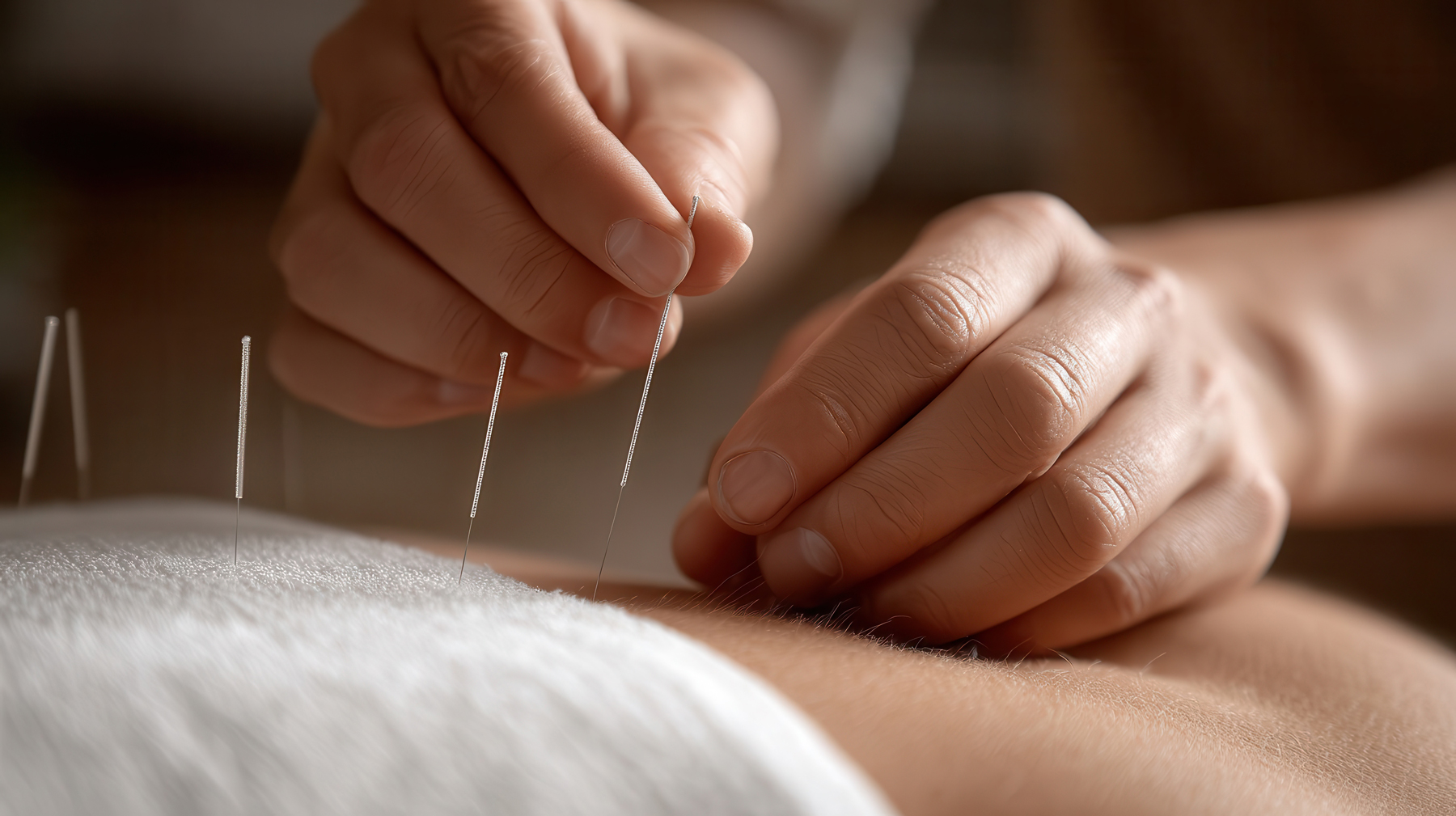 Integrating Acupuncture in a practice for Healthcare Professionals ...